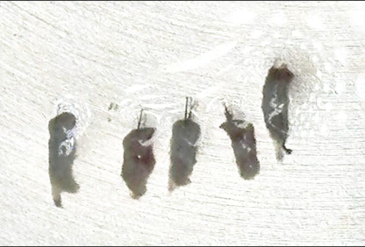 How to avoid extraction of the telogen hairs. - Absolute hair clinic